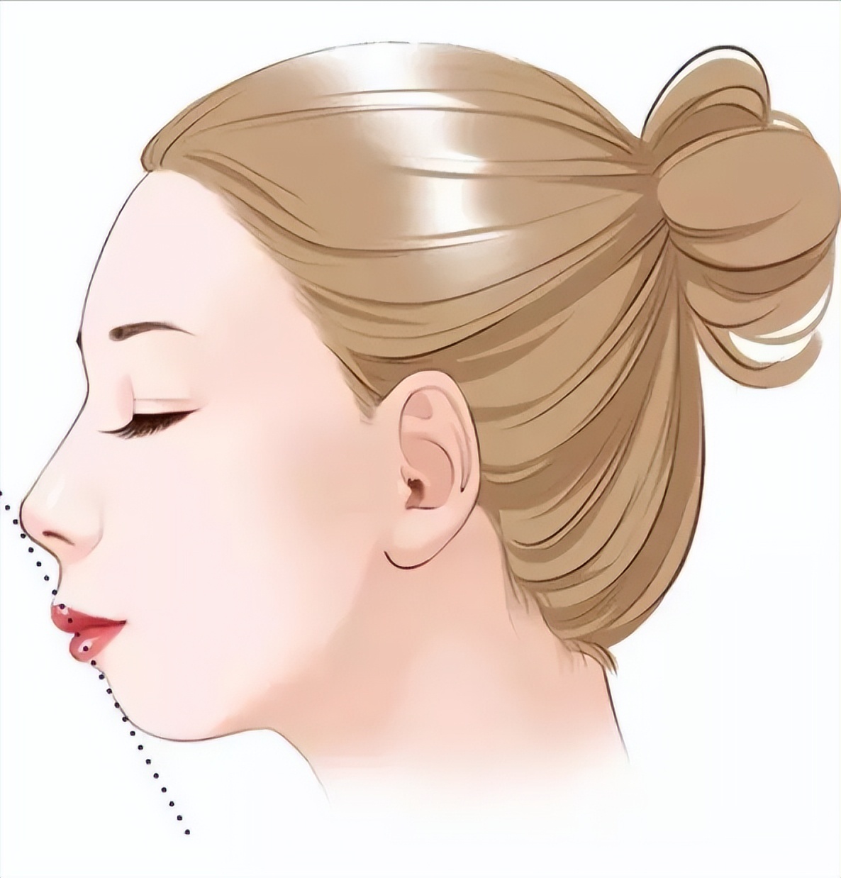 [Orthodontics]A means to improve the shape of the face? - iMedia