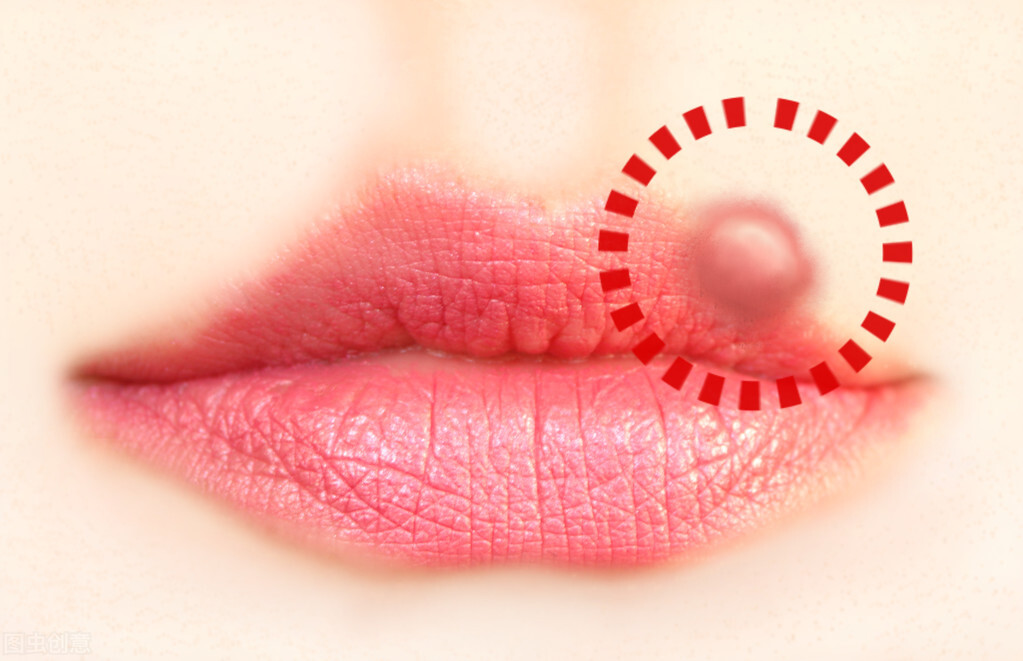 How to treat blisters, abscesses, and male genital herpes? - iNEWS