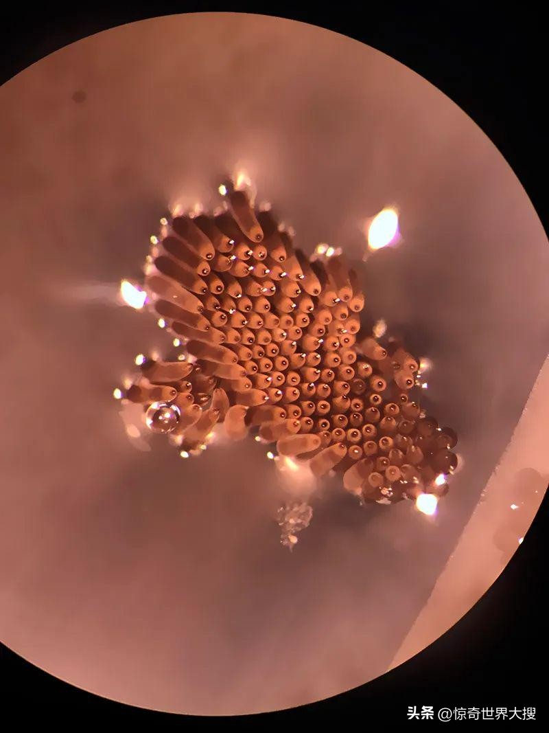 20 amazing microscope pictures, eye-opening after reading! - iNEWS