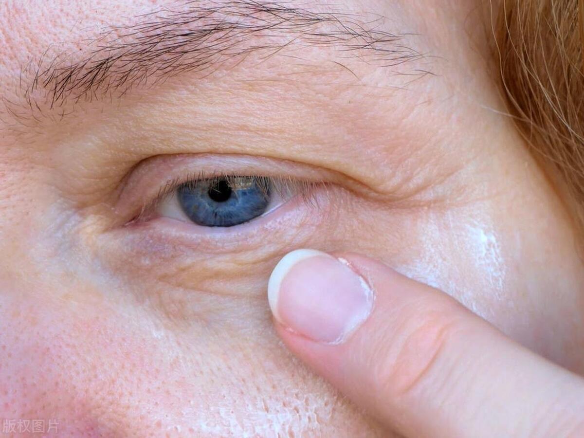 How to maintain loose eyelid skin? - iNEWS