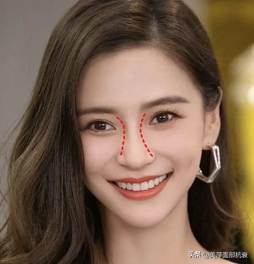 Taking stock of the 4 beautiful noses among female stars in the ...