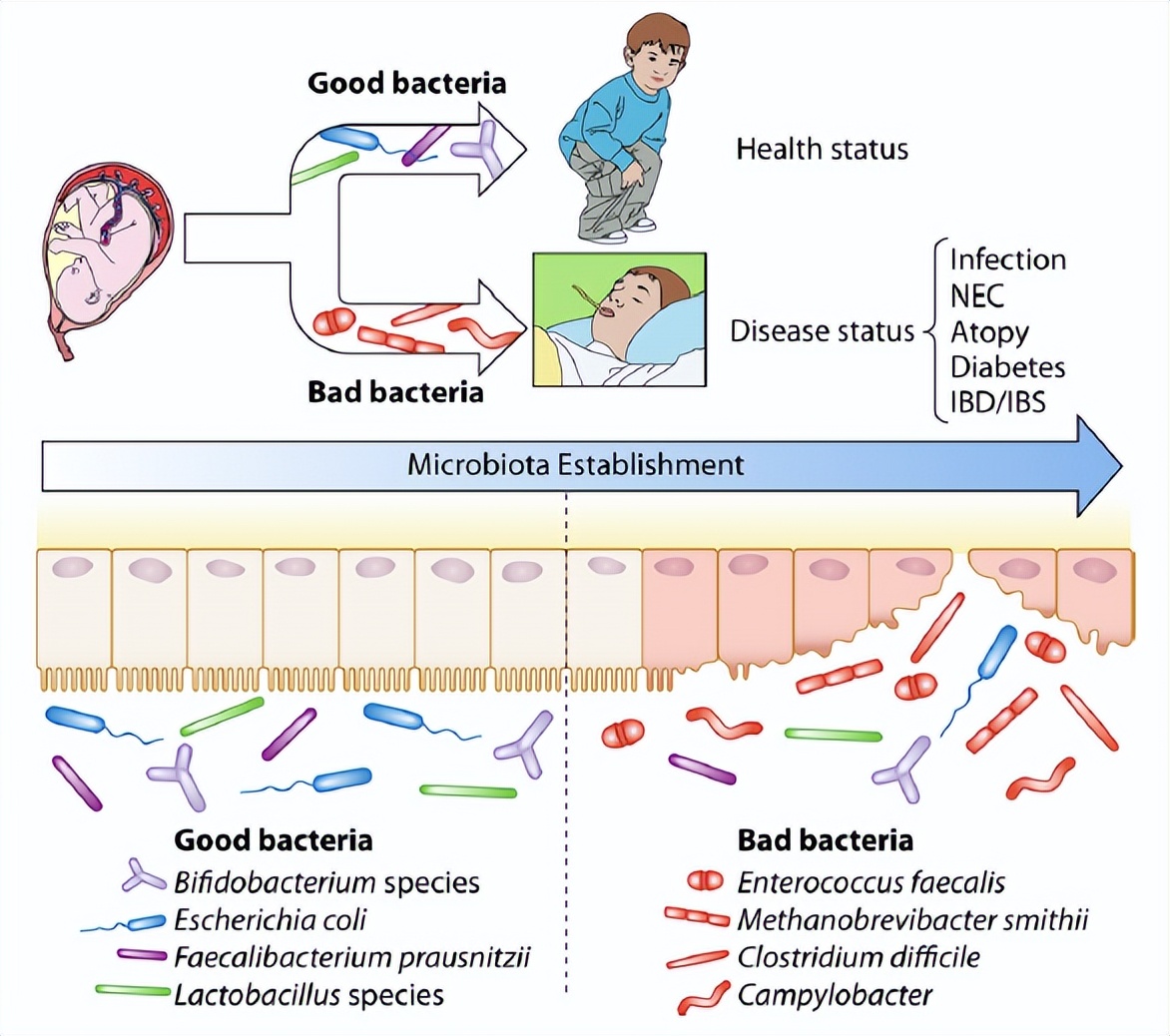 See the old with the small?Intestinal flora colonization in early life ...