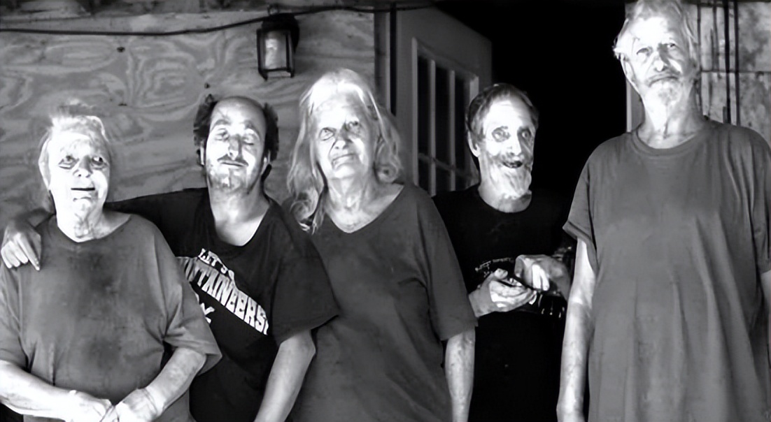 The scariest incest family in the United States: Facial deformities ...