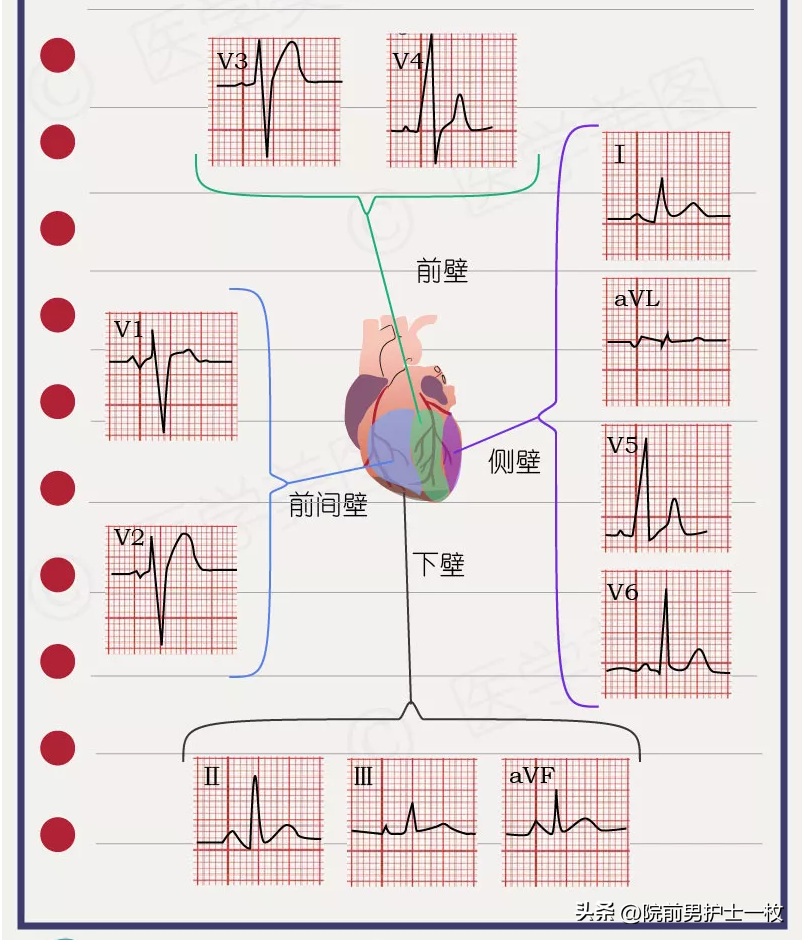 Arrhythmias—emergency management of patients with atrial fibrillation ...