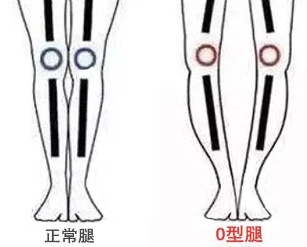 Outer eight legs, X-shaped legs, O-shaped legs, these 10 beautiful ...