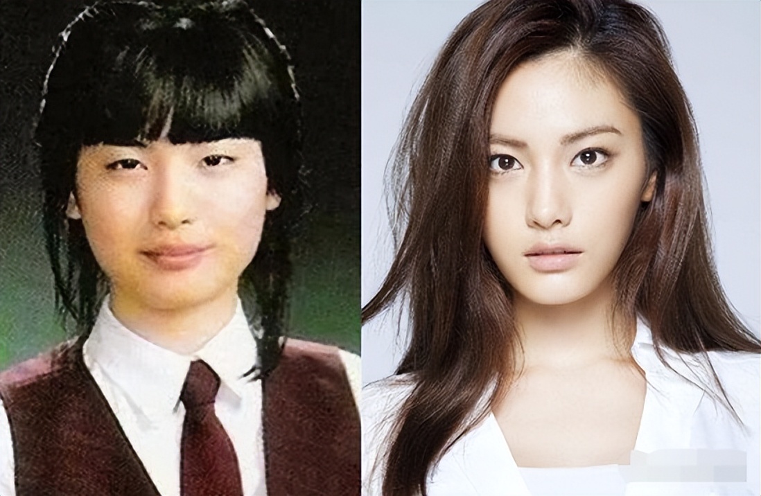 The 22-year-old actor went to South Korea for plastic surgery and died ...