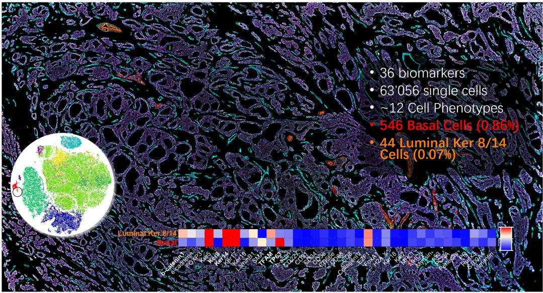 Discovery of single-cell spatial phenotypes begins with understanding ...