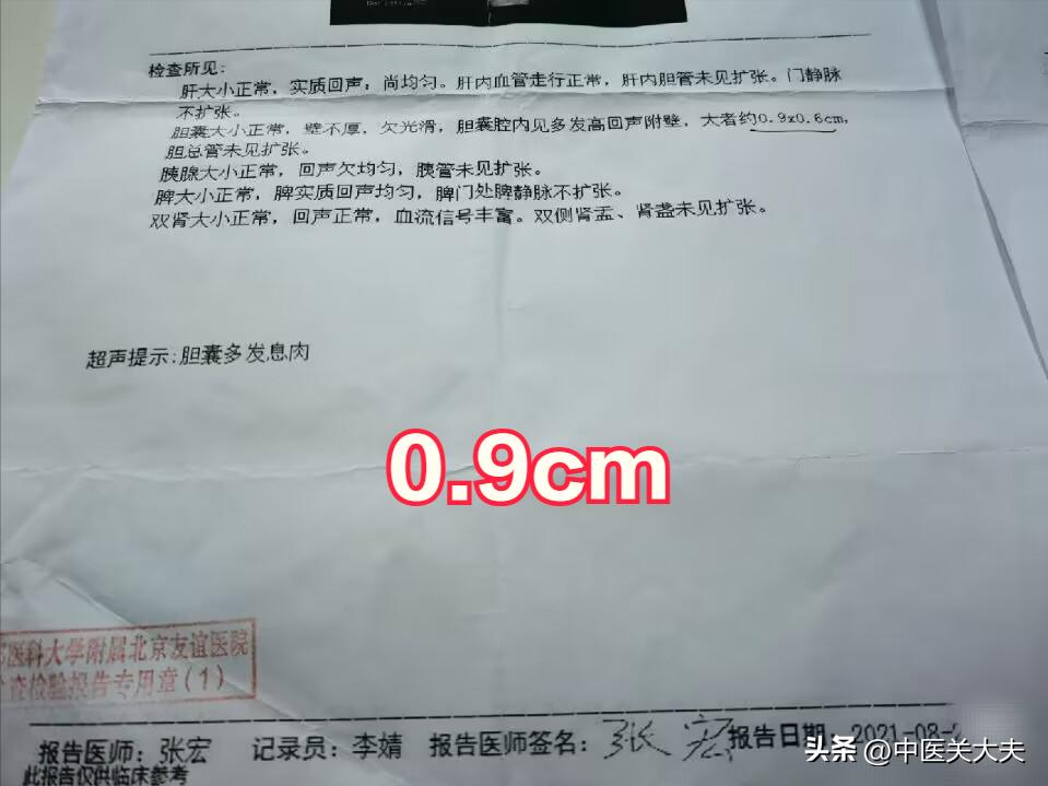 6-year history of gallbladder polyps, Chinese medicine treatment for ...