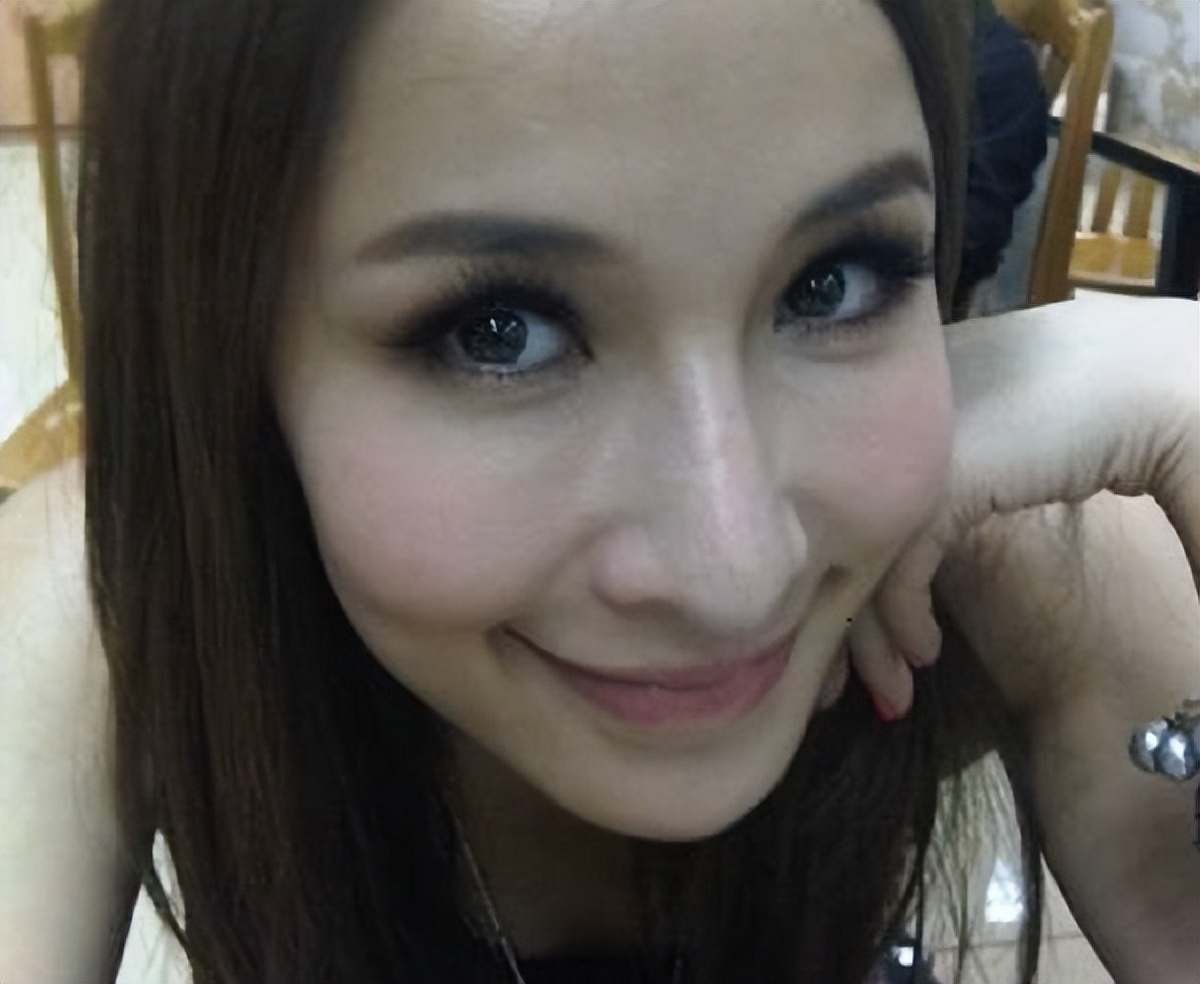 Because plastic surgery ruined their careers, changed their face beyond ...