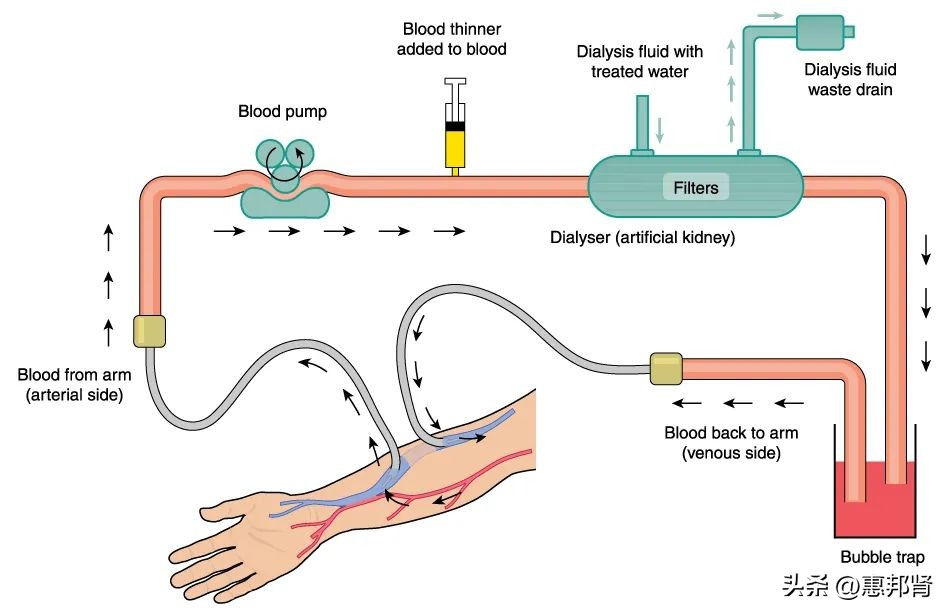Once dialysis, will it be a lifetime? - iNEWS