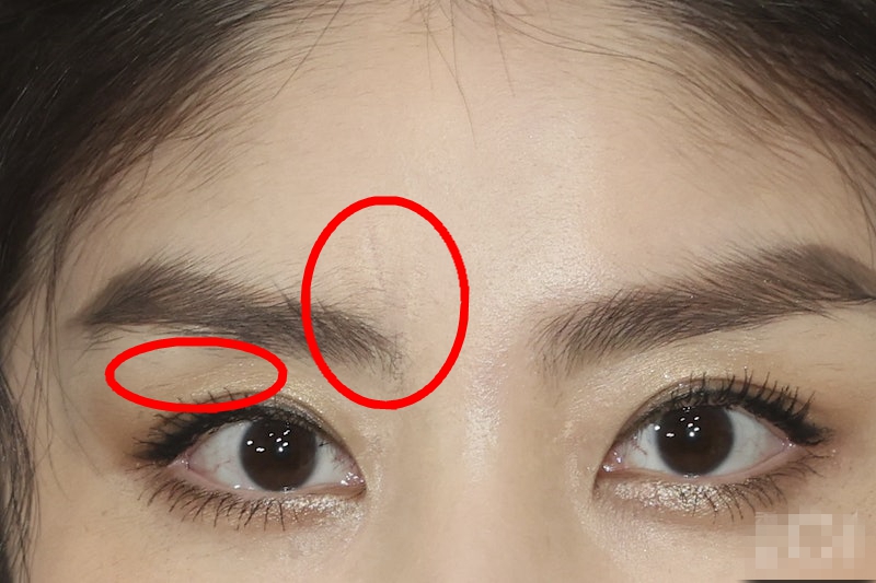 Kelly Chen first talked about the details of the car accident injury ...