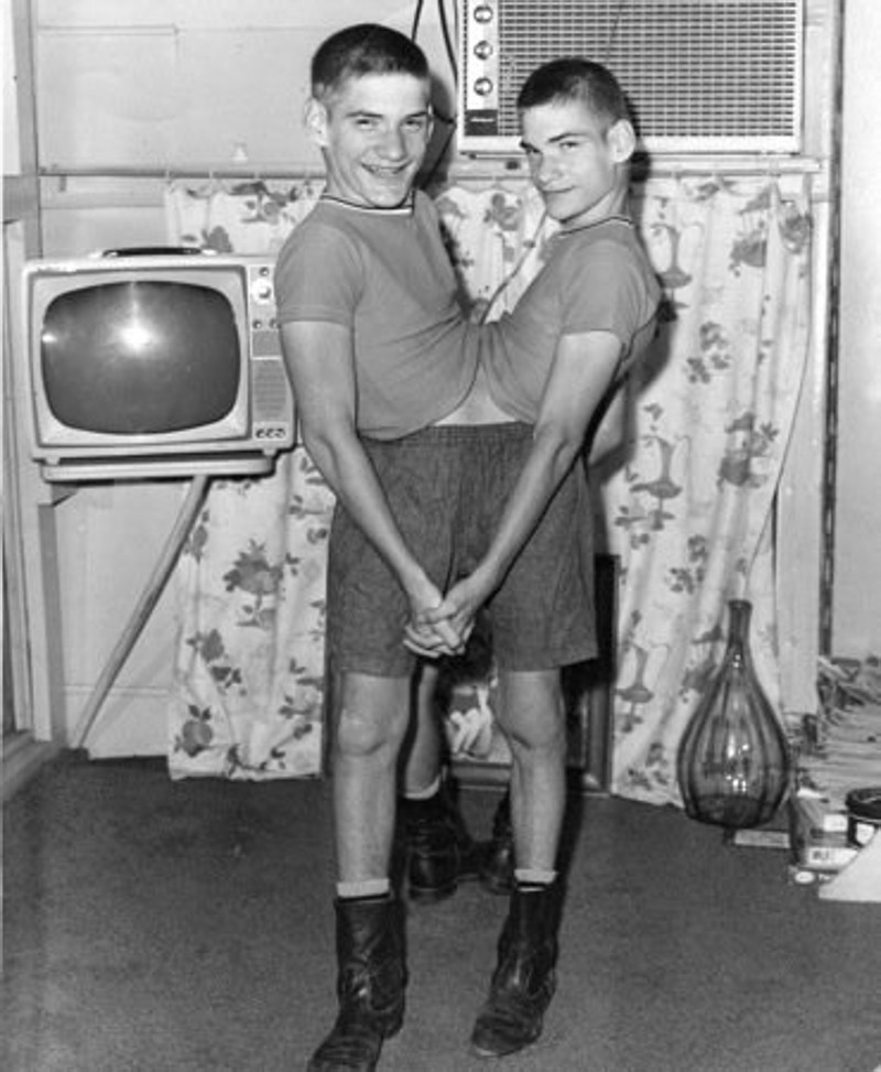 The world's longest-lived conjoined twins share their bodies for 68 ...