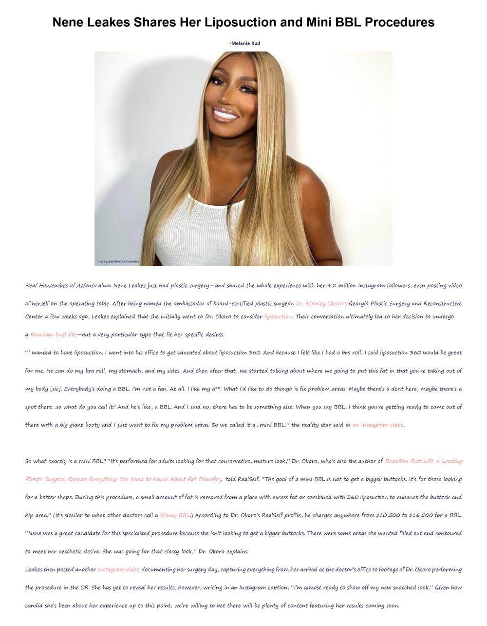 'Atlanta's Wife' Nene Leakes Shares Her Liposuction and Mini BBL ...