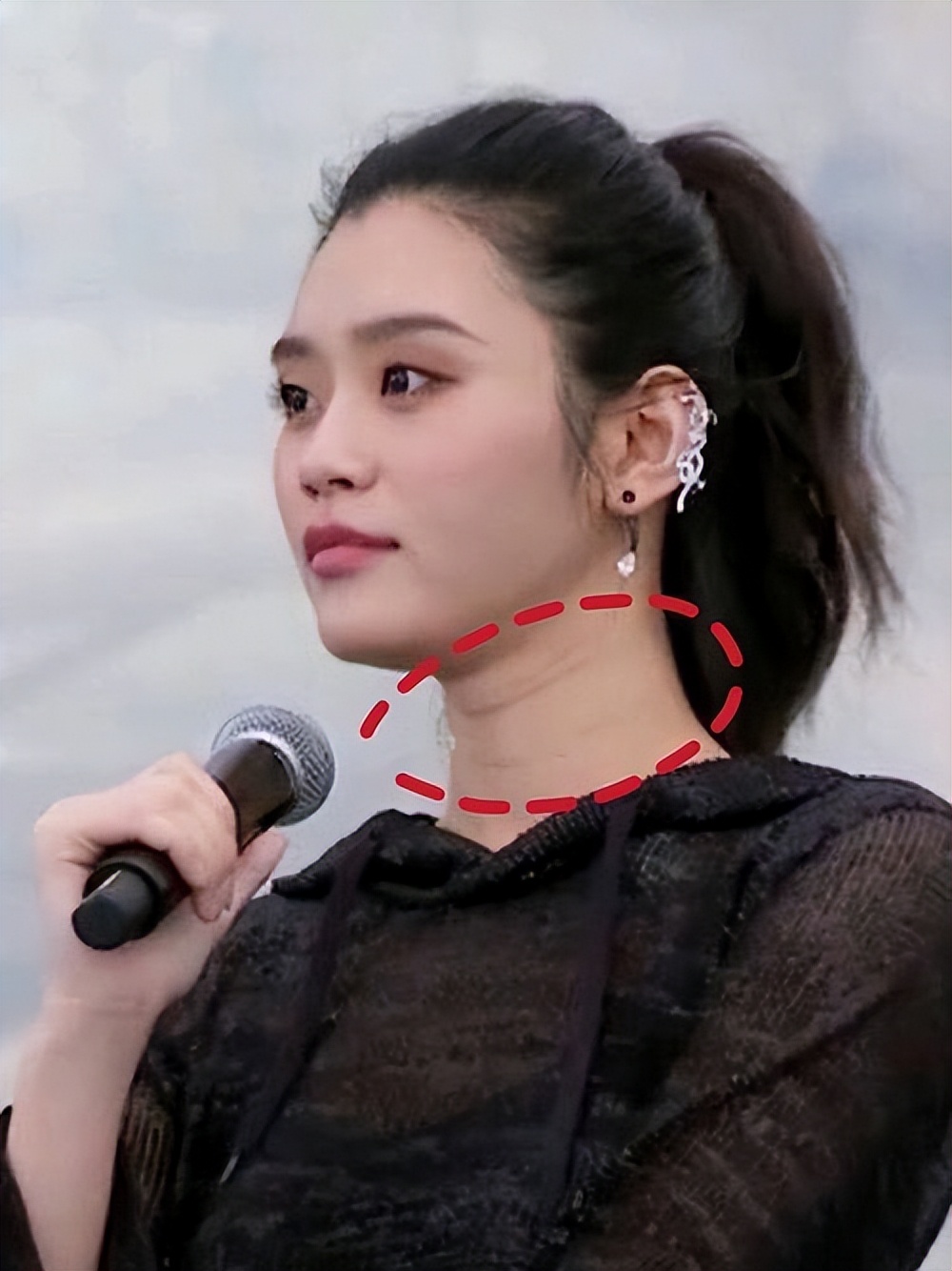 "Three stripes" often appear on the neck, don't know what it means, it ...