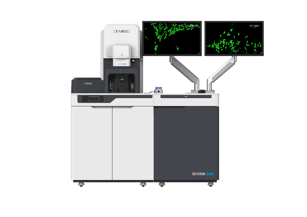 Super-resolution imaging of subcortical white matter using stochastic ...