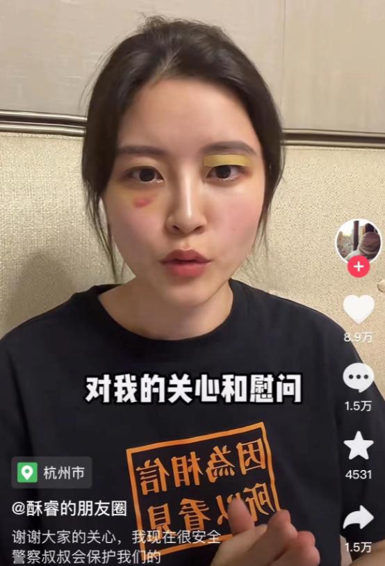 Good Voice trainee Su Rui was beaten, her nose was bruised and her face ...