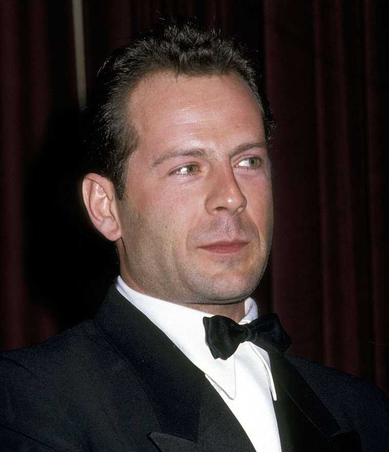 Before and after photos of 15 well-known actors with bald heads, some ...