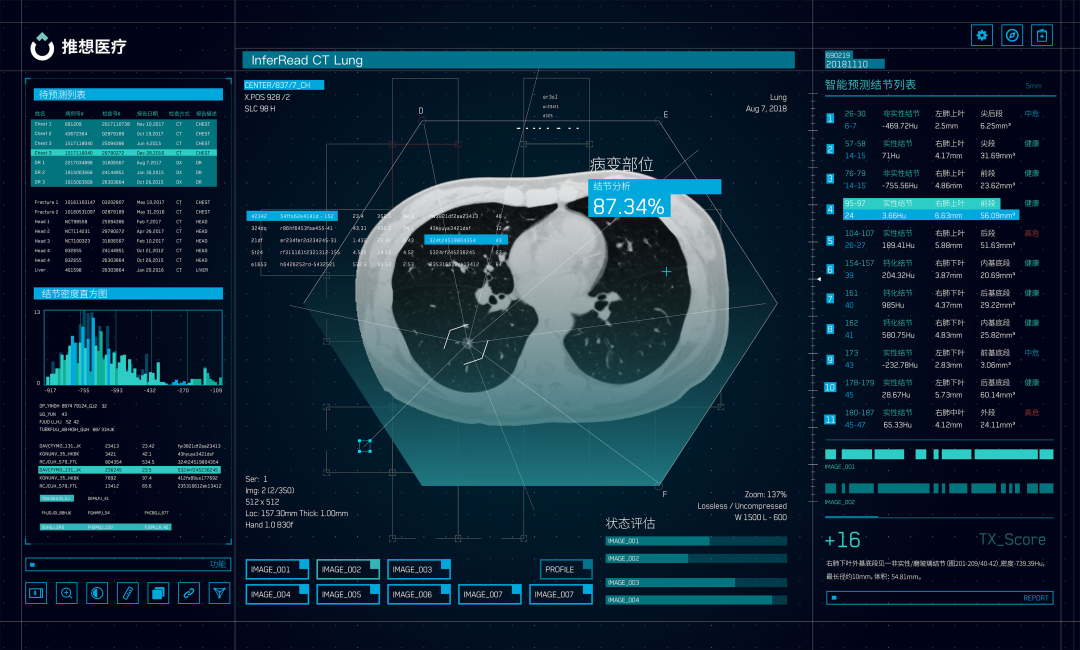 What are the top devices and drugs used to give lung cancer patients a ...