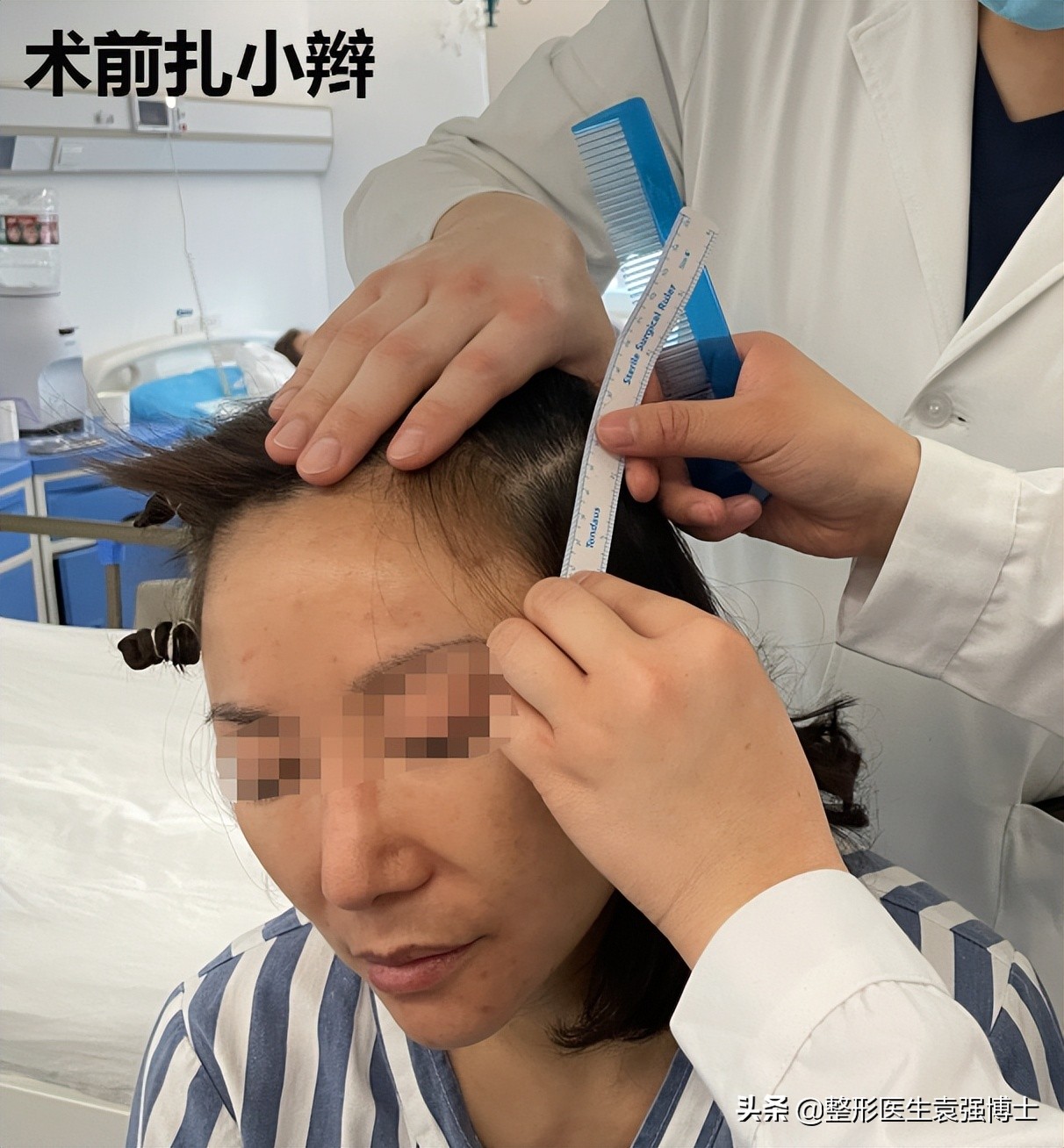 At 47 years old, I had a small temporal facelift + facetite. I was ...