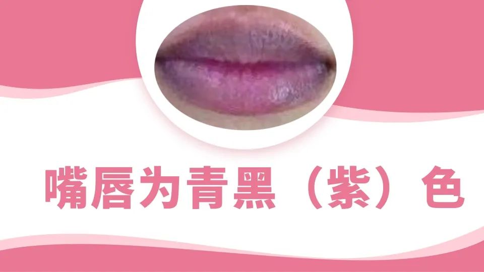 How does TCM "read" the body from the color of the lips?Teach you all ...