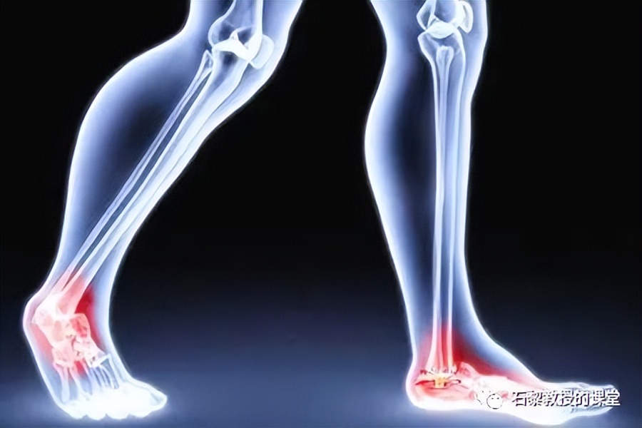 Pathological analysis and solutions of bone diseases such as arthritis ...
