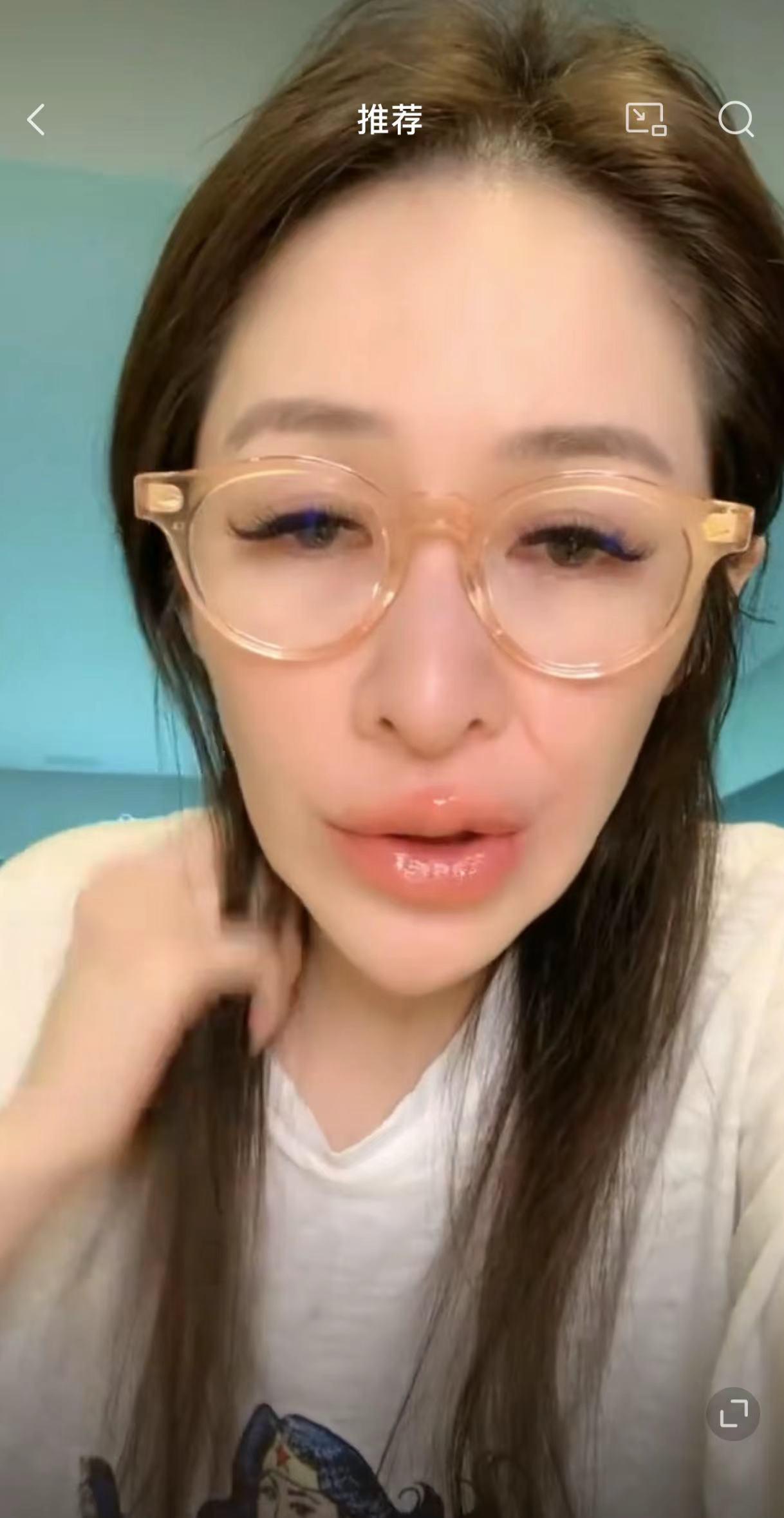 Hsiao Yaxuan's "plastic face" appeared in the live broadcast, and ...