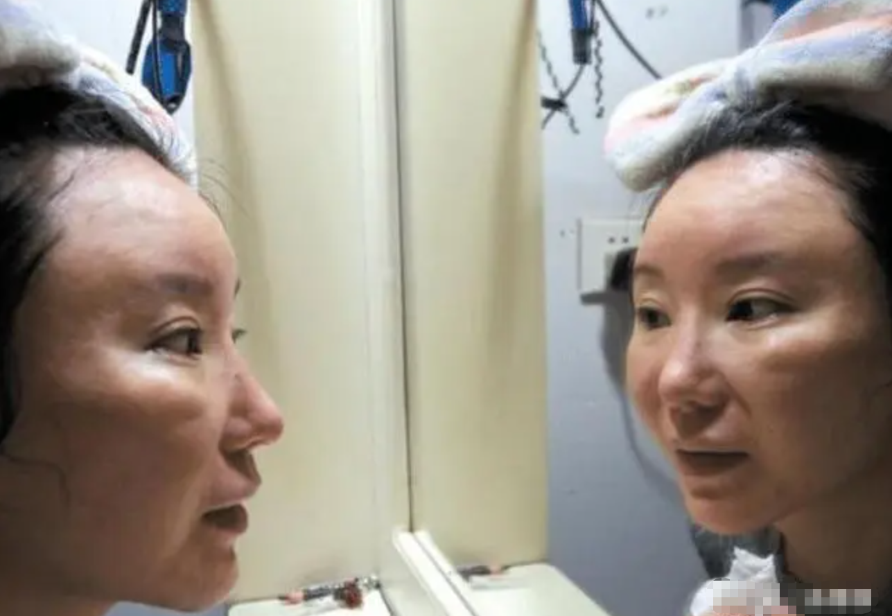 Pink Baby: Started plastic surgery at 16 years old - iNEWS