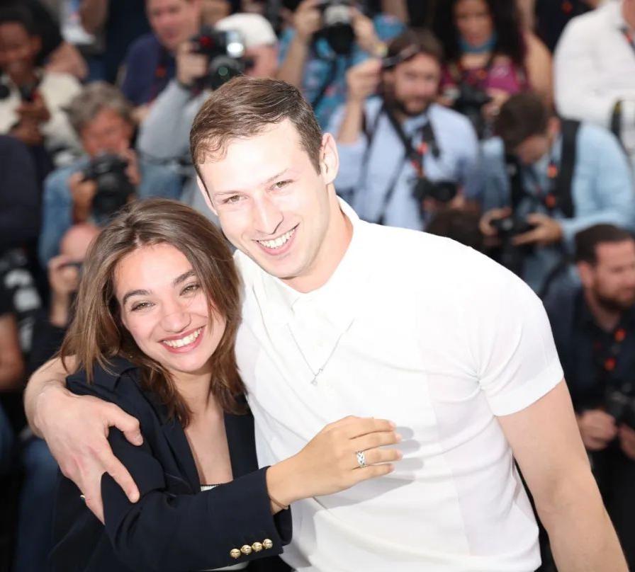 29-Year-Old Israeli Actor Goes Bald in His Twenties With Hair ...