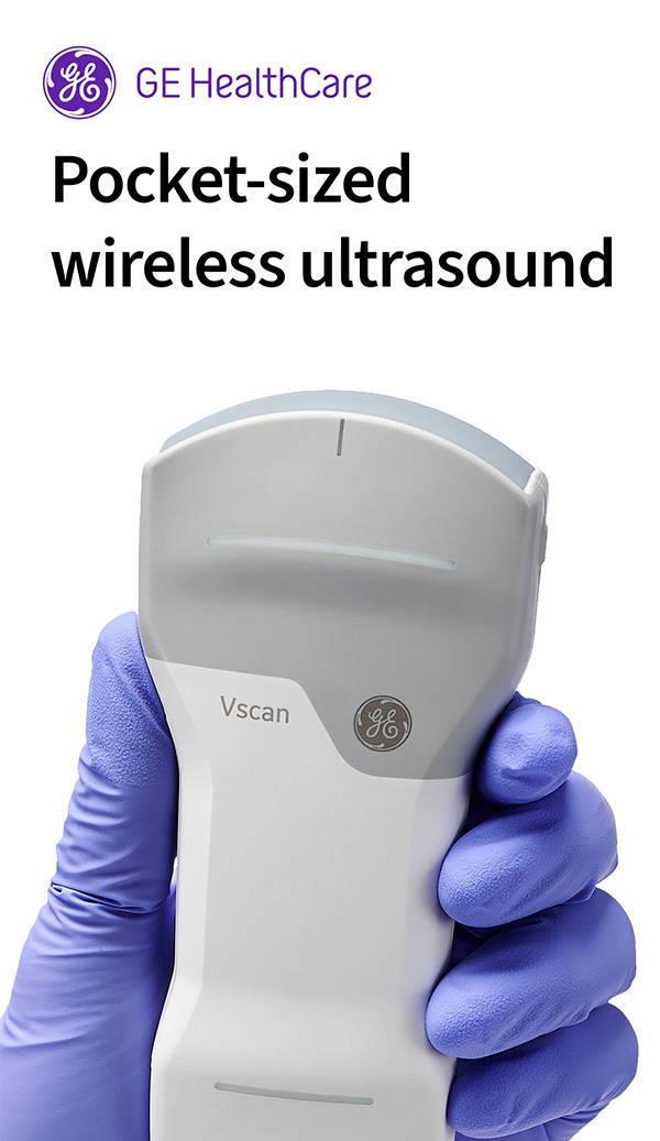 Scan your entire body anytime, anywhere, with this “pocket ultrasound ...