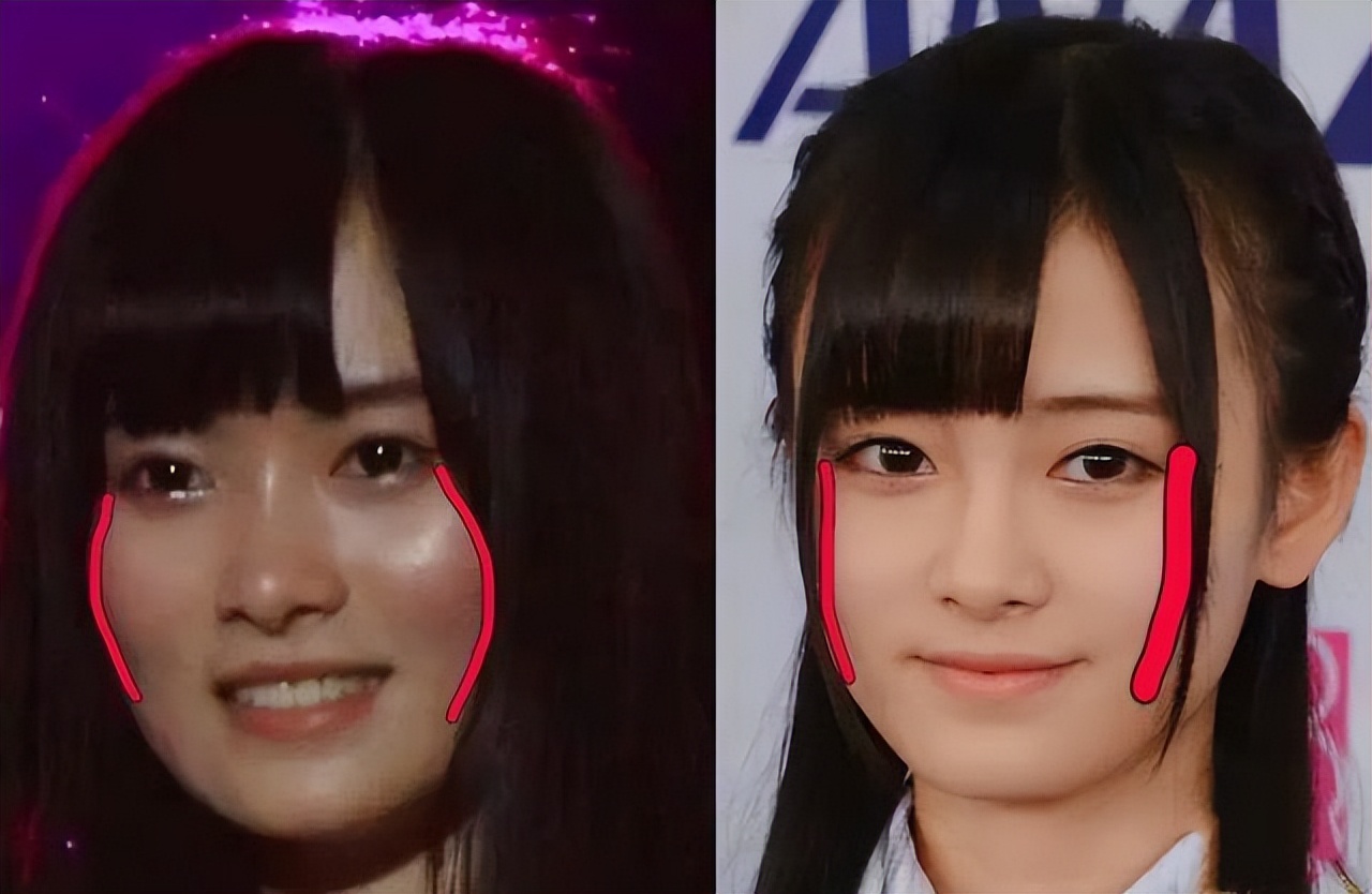 Alpine nose, awl face, cheekbones pushed inward, the stars of the ...