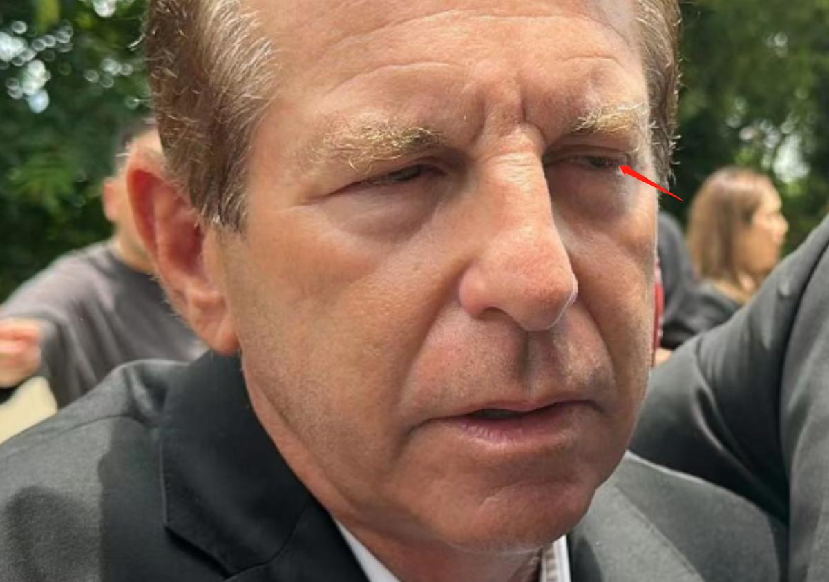 Coco Lee's husband was under siege! Two blood marks were pinched out of ...