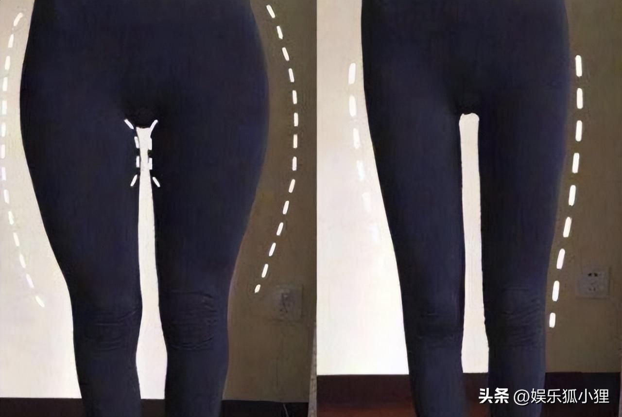 What is the difference between "women's hip" and "hip"? Look at the ...