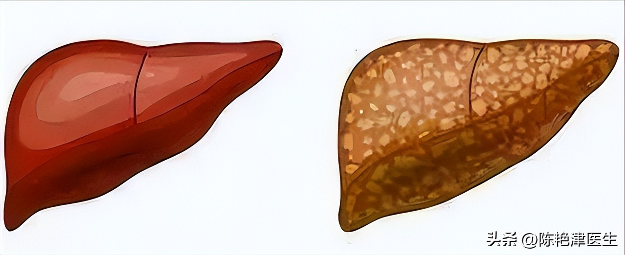 Bad liver, face prophet? There are 4 symptoms on the face, it may be ...