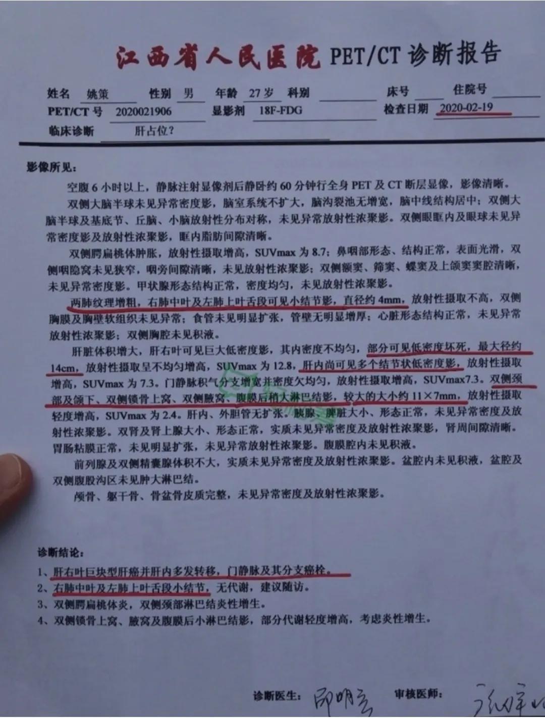28 The civet cat mistakenly changed the condition of the prince's liver ...