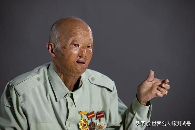 "Living Qiu Shaoyun" Tu Boyi: The fire destroyed his appearance, but he ...