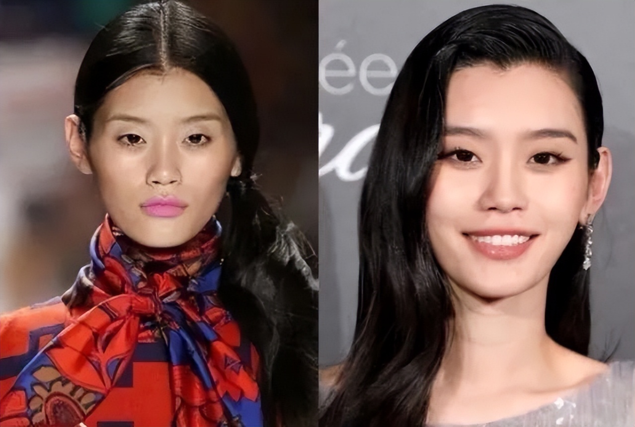 Xi Mengyao had plastic surgery? The nose is reduced, the face is filled ...