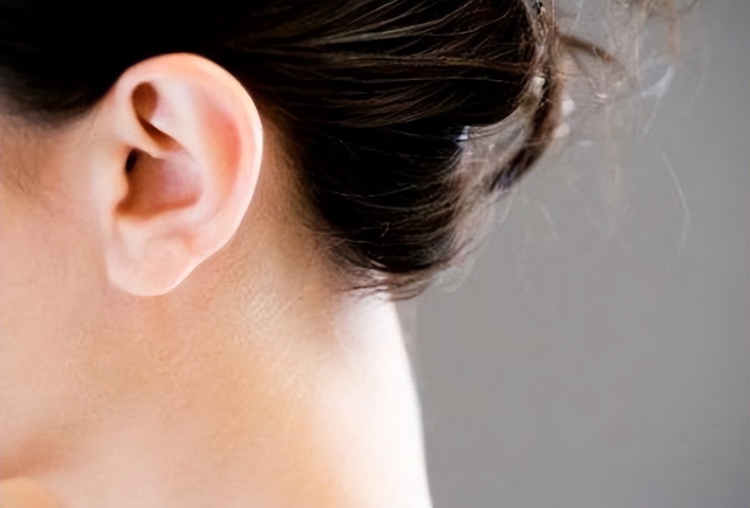 Where did the crease on the earlobe come from? Is it related to sudden ...