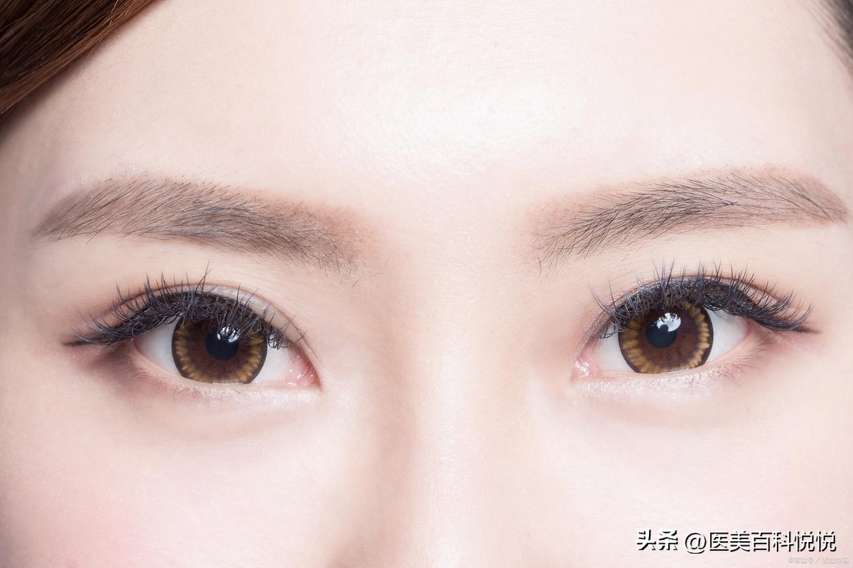 Taizhou Suwang——Which of the four double eyelid shapes is suitable for ...