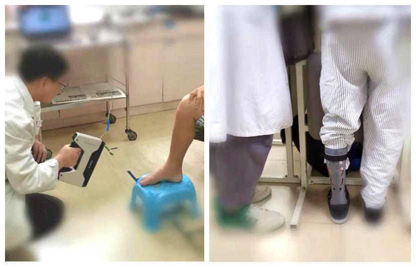 Stroke paralyzed unable to stand ankle-foot orthosis to help recovery ...