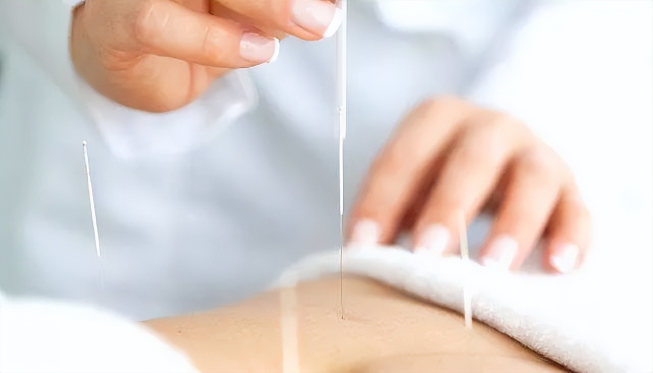 Popular science: Sudden fainting during acupuncture?Understand the ...