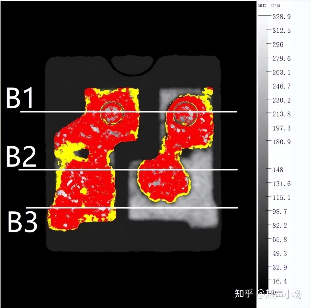 Chip failure detection - chip defect ultrasonic scanning microscope ...