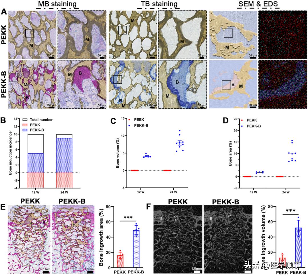 Academician Zhang Xingdong "Sci. Adv.": Bone regeneration induced by ...