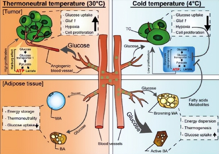 'Cold therapy' is safe, scientists find cold can inhibit glucose uptake ...