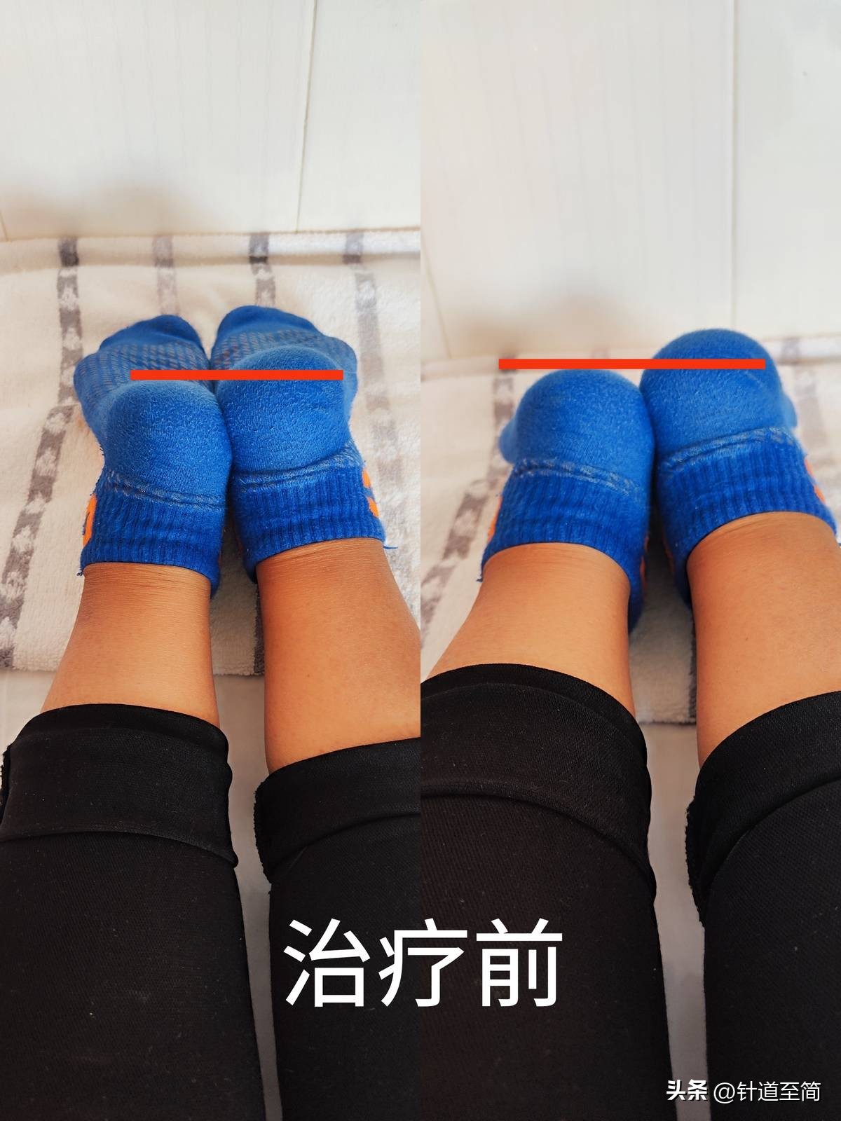 Long and short legs?Chinese medicine has a method - iNEWS