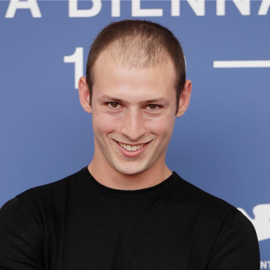 29-Year-Old Israeli Actor Goes Bald in His Twenties With Hair ...