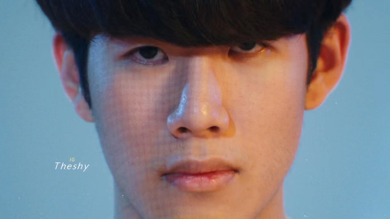 LOL: TheShy underwent eye surgery after a 20cm hand wound, just to get back to the top? - iNEWS