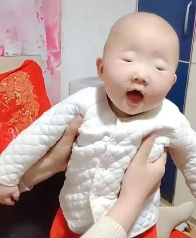 The "smallest eye" baby is on fire, and when he is awake, he is still ...