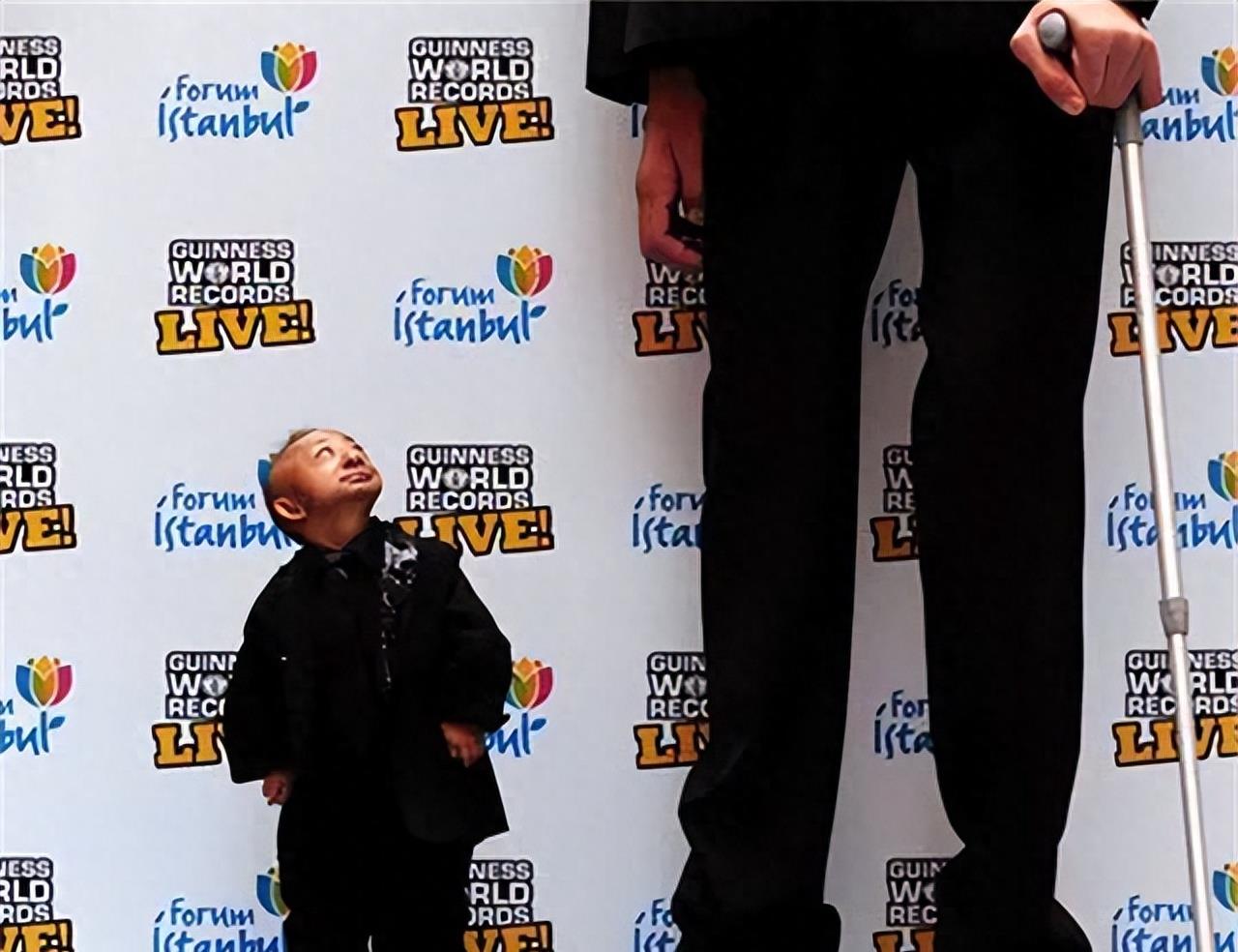 He Pingping, the "world's number one dwarf", passed away suddenly 10 ...