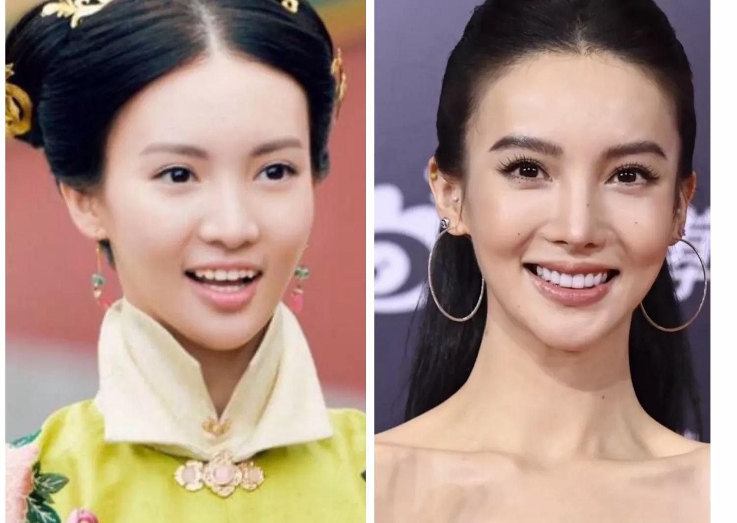 The porcelain teeth of these actors are played one by one - iMedia