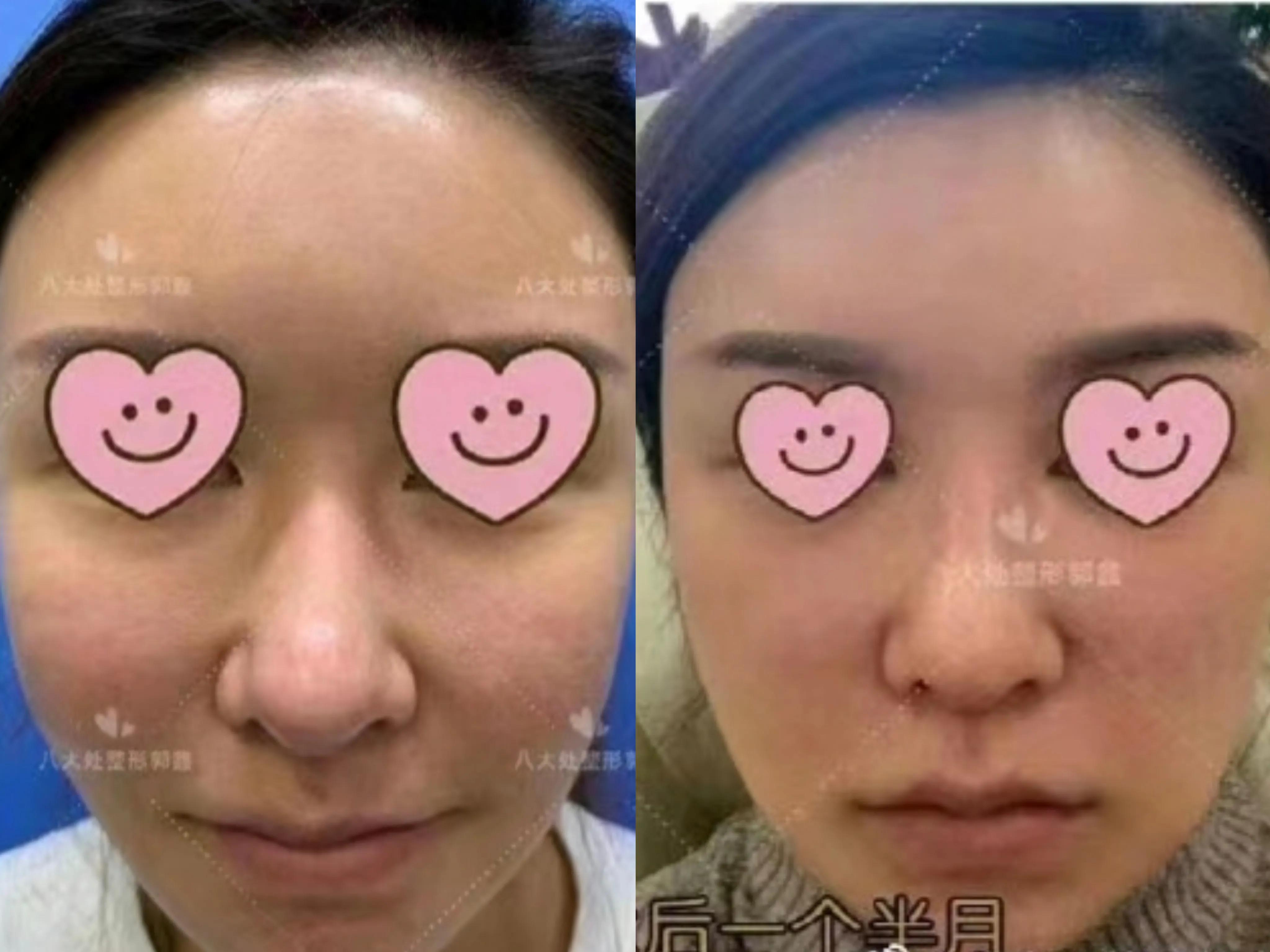 34-year-old Lou Yixiao's "plastic surgery" caused controversy, her face ...